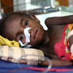 Around 100 West Papuan children die from malnutrition and measles, more ...